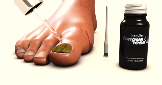 Fungusless | FungusLess nail fungus infection treatment